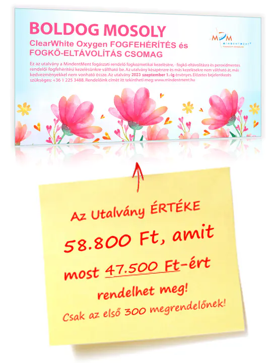 Tavaszi Boldog Mosoly Utalvány - MindentMent Rendelő